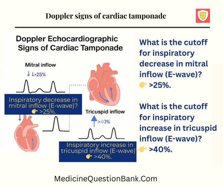 Doppler signs of cardiac tamponade - Medicine Question Bank