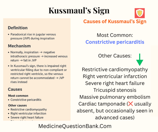 Kussmaul’s Sign - Medicine Question Bank