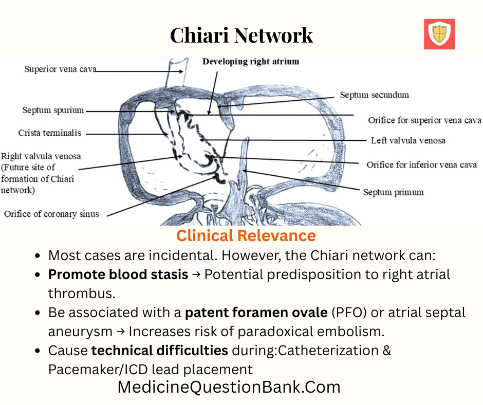 Chiari network - Medicine Question Bank