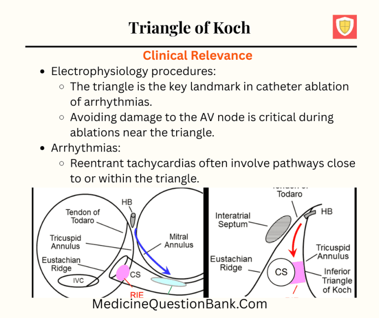 Triangle of Koch - Medicine Question Bank
