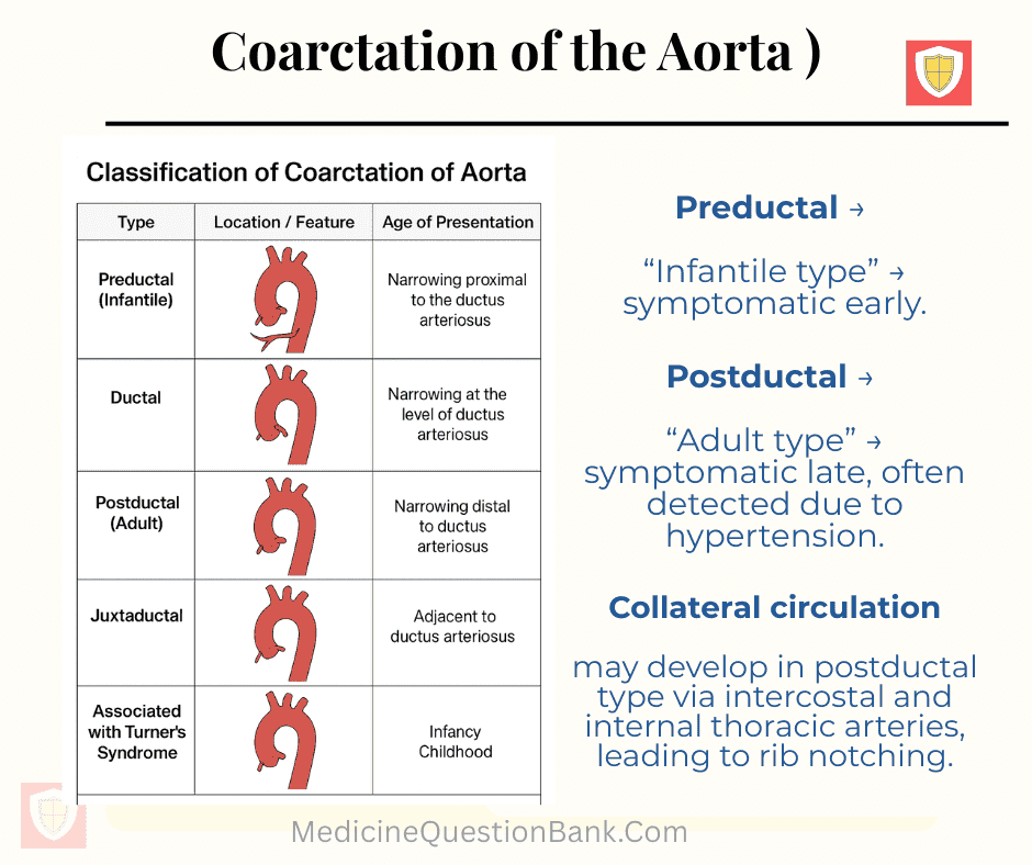 Coarctation of the Aorta - Medicine Question Bank